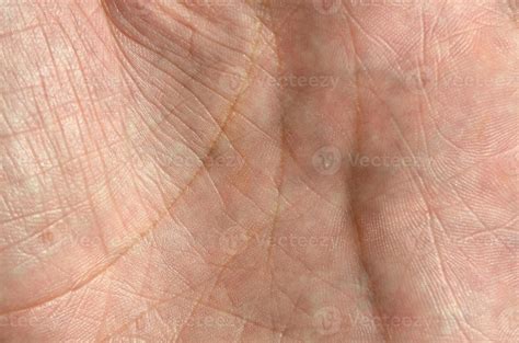 Close Up Of Human Hand Skin With Visible Skin Texture And Lines
