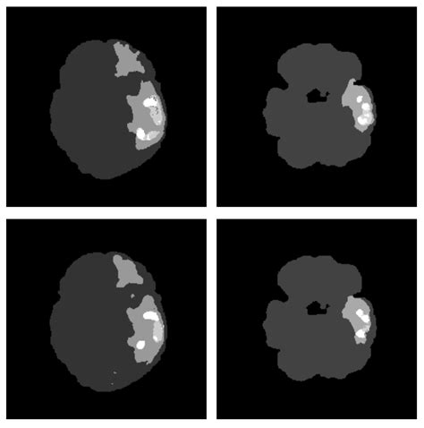 Handling Unbalanced Data In Deep Image Segmentation By Dong Chen Medium