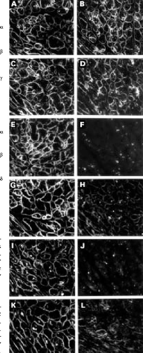 Figure 1 From Disruption Of Heart Sarcoglycan Complex And Severe