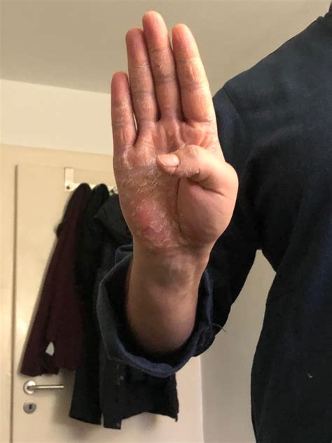 Hand Control Object Detection Dataset By Yolov5