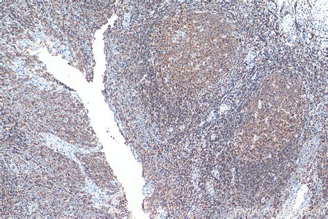 Ihceasy Cd45 Ready To Use Ihc Kit United Bio Research