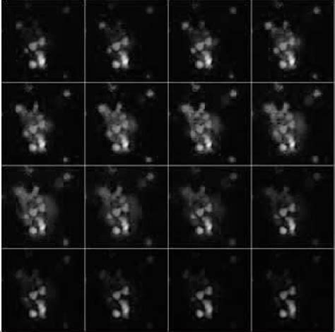 C Confocal Microscopic Analysis By Laser And Z Stack Method