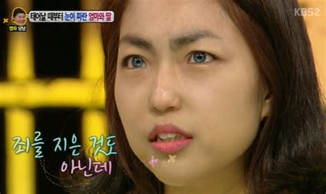 안녕하세요 파란눈모녀 동양인 파란눈 아픈거 아니에요 네이버 블로그