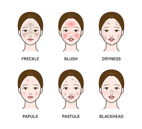 블랙헤드 유토이미지 검색 결과