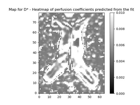 Intravoxel Incoherent Motion Ivim — Dipy 1110 Documentation
