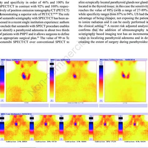 From Top To Bottom And From Left To Right Sestamibi Scan Delayed Download Scientific Diagram