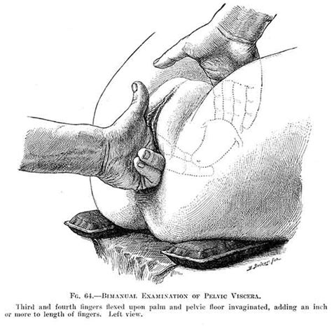 The Gynecological Palpation Touch By Dr Nelson Soucasaux At The Museum Of Menstruation And