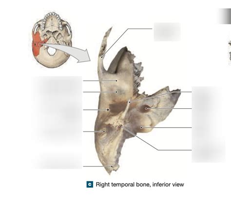 Right Temporal Bone Inferior View Diagram Quizlet