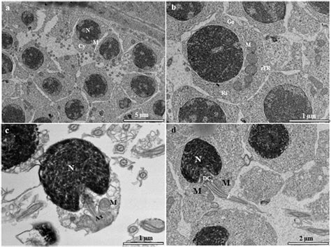 Transmission Electron Micrographs Of Spermatid Stages In The European