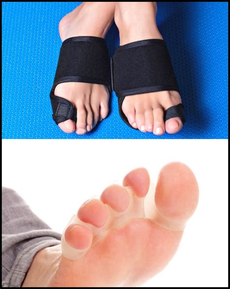 무지외반증교정밴드 착용해도 잠깐 일 뿐입니다 네이버 블로그