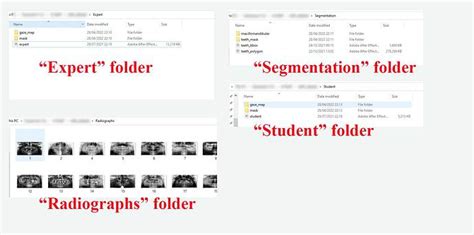 Importing Multiple Labelbox Annotation Formats To A Deep Learning Model Community Help Roboflow