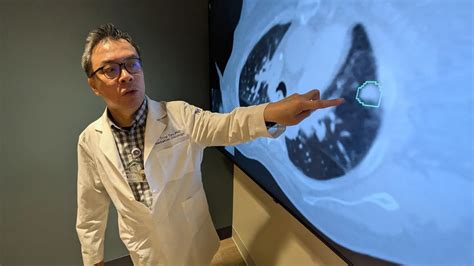 Ai Tool Iseg Improves Lung Tumor Segmentation For Radiation Therapy Memesita