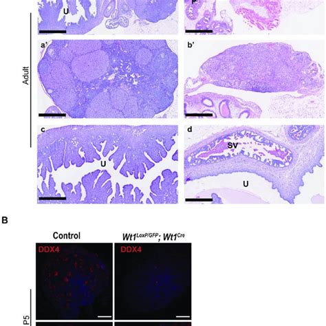 Ovarian Dysgenesis And Genital Tracts Containing Both Male And Female Download Scientific