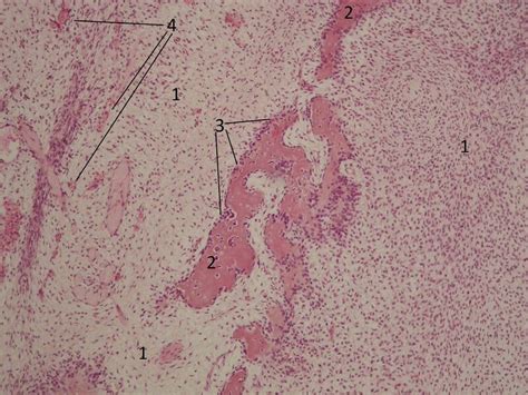 Intramembranous Ossification Slide Wikilectures