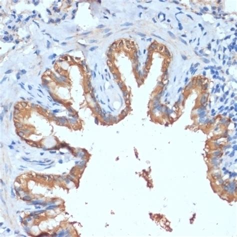 Hhla2 Antibody Cat No 14 877 Prosci