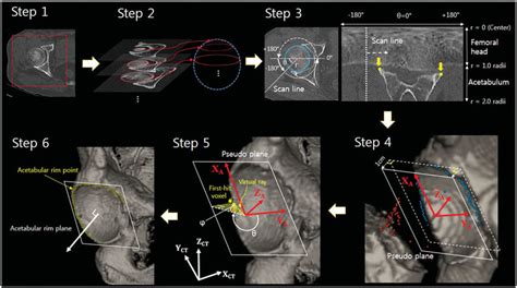 An Algorithm For Determining The Acetabular Rim Plane Which Consisted