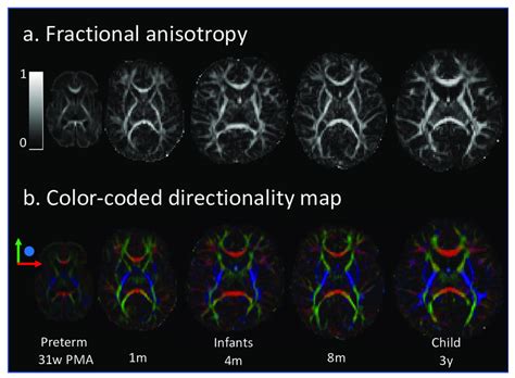 Evolution Of Dti Maps During Development Fractional Anisotropy A Download Scientific