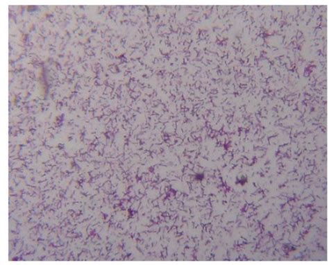 Self Healing Concrete By Biological Substrate