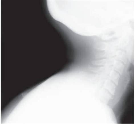 Chapter 7 Automatic Exposure Controls Flashcards Quizlet