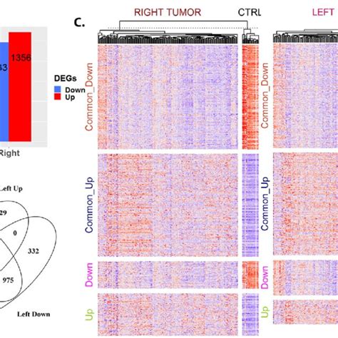 Transcriptional Signatures Of Right And Left Sided Colon Cancers A The Download Scientific