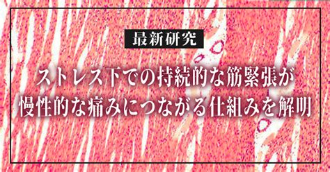 慢性疲労症候群や線維筋痛症における痛みのメカニズムが解明 理学療法士・作業療法士・言語聴覚士の求人、セミナー情報なら【post】