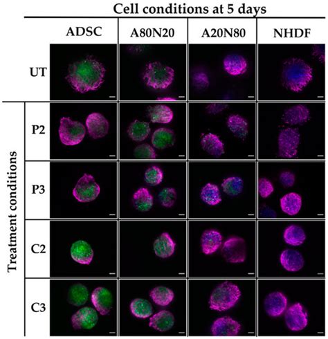 Phenotypic Modulation Of Adipose Derived Stem Cells And Fibroblasts Treated With Povidoneiodine