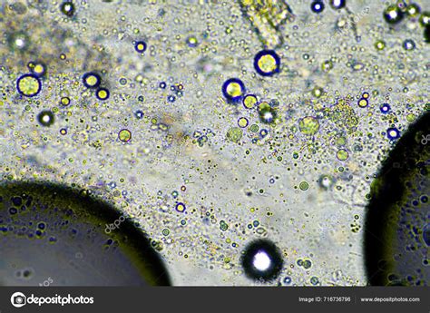 Yeşil Mukus Mikroskop Altında Öksürme Grip Hücrelerine Avustralya Da