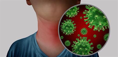 How Long Does Strep Throat Last University Urgent Care