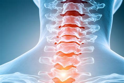 What Is C Spine Surgery A Guide To Cervical Spine Procedures