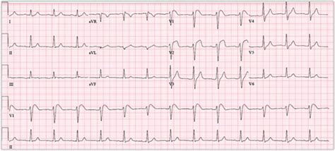 Ama Ed Hub On Linkedin A Young Man With Syncope
