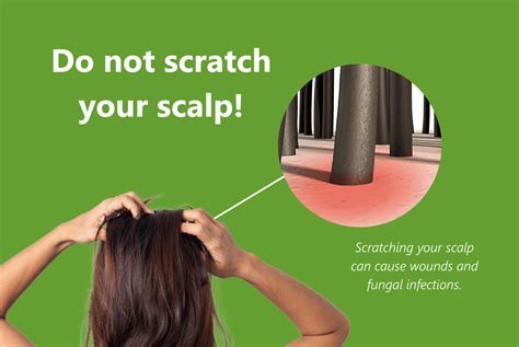 How To Get Rid Of Dandruff Tips For Oily Dandruff Dry Dandruff Aromase