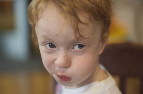 Simple Ways To Stop Hiccups Quickly LifeHack