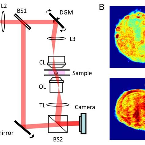 Imaging Myeloma Cells With Digital Holographic Tomography A Digital
