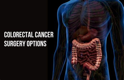 Surgical Options For Colorectal Cancer What To Expect Before During And After Surgery By Dr