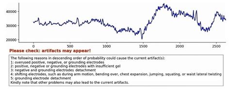 Sensorder Artifact Classification During Biosignal Acquisition Universität Bremen