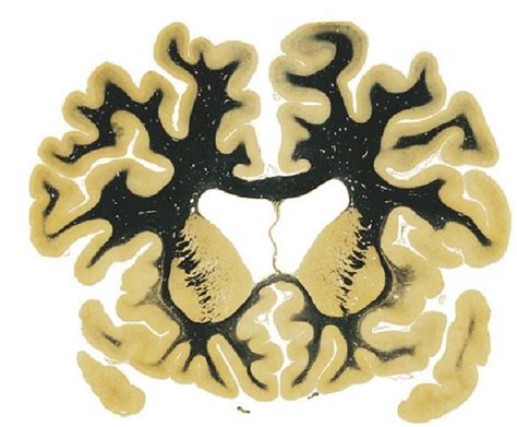 Coronal View Diagram Quizlet