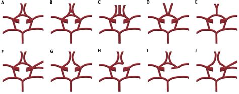 Schematic Diagrams Showing The Morphological Variations In The Anterior