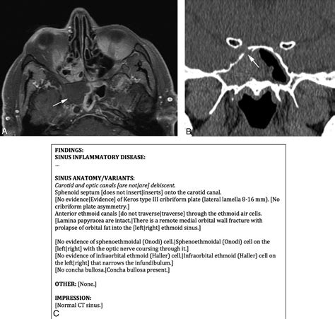 Contextual Radiology Reporting A New Approach To Neuroradiology Structured Templates American