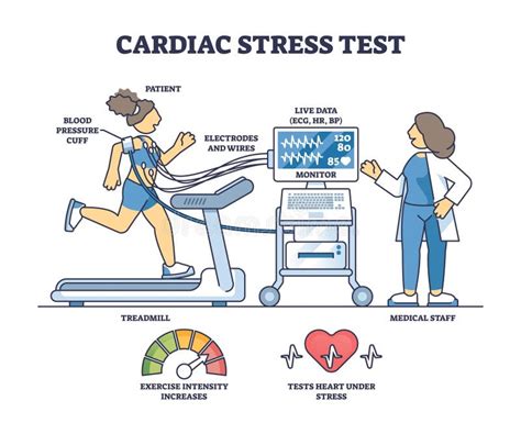 Cardiac Stress Test Diagram Shows A Patient On A Treadmill Stock