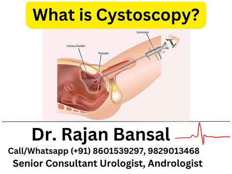 Rgu And Mcu Urethrography