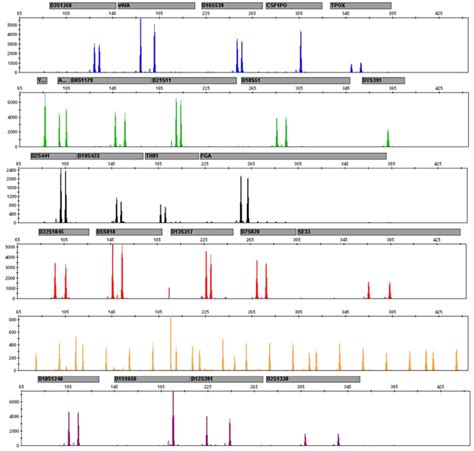 Teaching Artificial Intelligence To Read Electropherograms Forensic