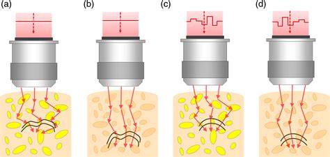 Collaborative Effects Of Wavefront Shaping And Optical Clearing Agent