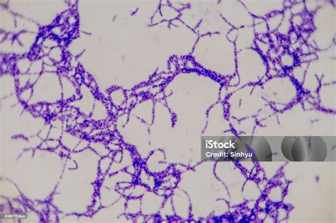 Bacillus Is A Genus Of Grampositive Rodshaped Bacteria And A Member Of