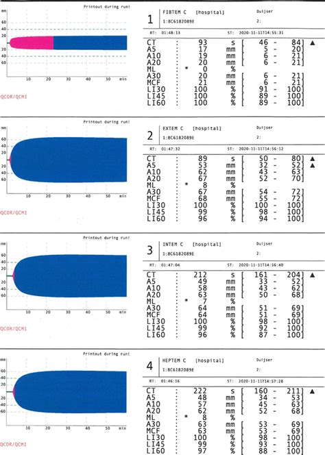 Rotem Analysis After Protamine In Heptem Coagulation Is Activated As Download Scientific