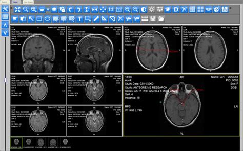 Deploy Healthcare Pacs And Ohif Dicom Viewer By Mrakftech Fiverr