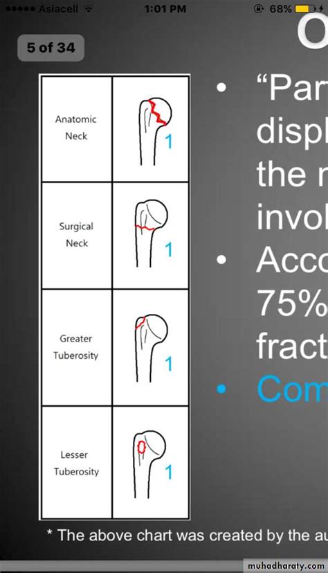 Neer Classification Pptx د محمد الموسوي Muhadharaty