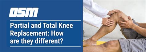 Partial And Total Knee Replacement How Are They Different