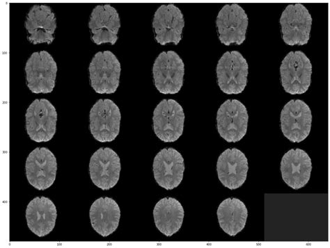 Python 讀取、顯示 Nifti 影像教學與範例 Office 指南