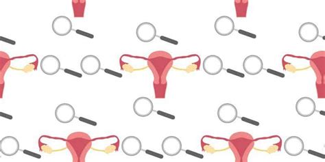 Pengobatan Pcos Yang Disarankan Dokter •