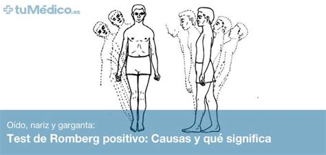Test De Romberg Positivo Causas Y Qué Significa